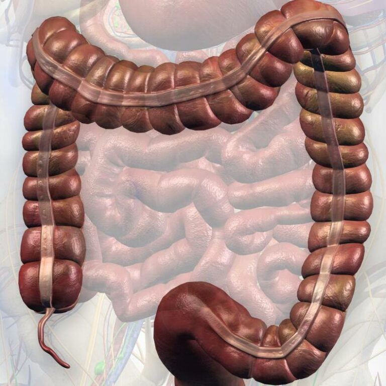 Appendicitis treatment in Ahmedabad | Low Cost Appendectomy