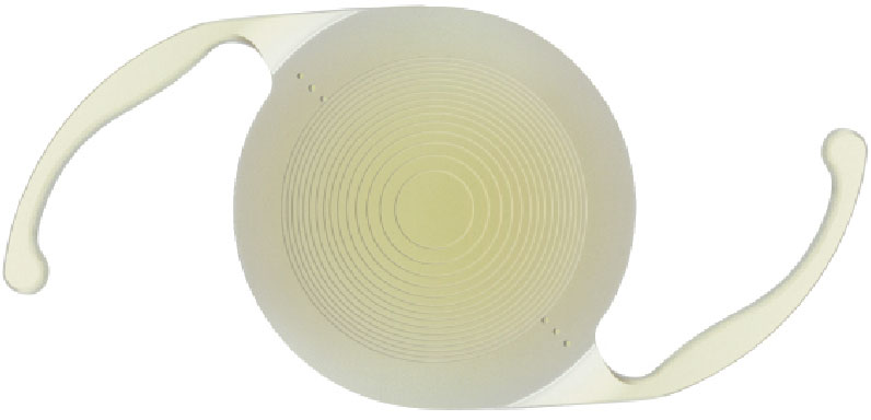 PanOptix Lens: Meaning, How It Works, Benefits And Risks