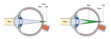 Symfony Lens- How Much Does It Cost?